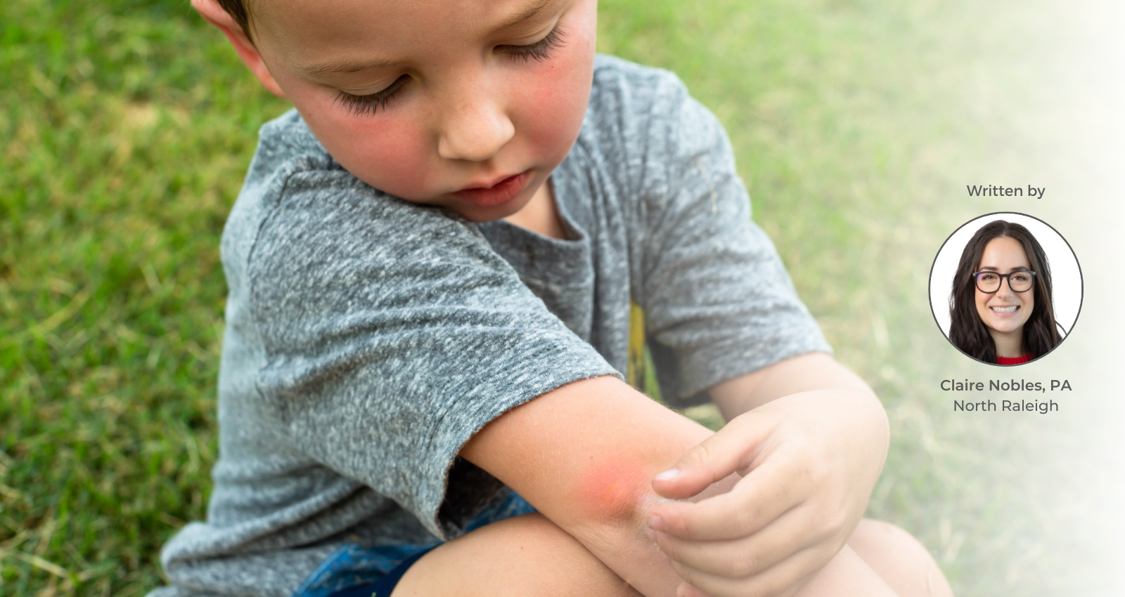 Your Ultimate Guide to Tackling Ticks and Insect Bites with Claire ...